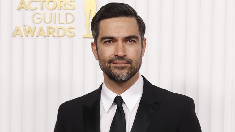 Revela Alfonso Herrera que RBD le dejó daños psicológicos | NVI Istmo